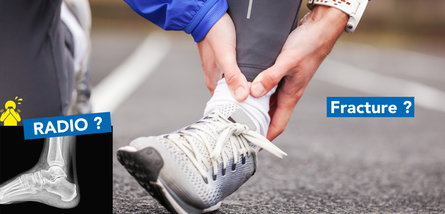Radio de la cheville après votre entorse, une obligation ? - Digitalrehab